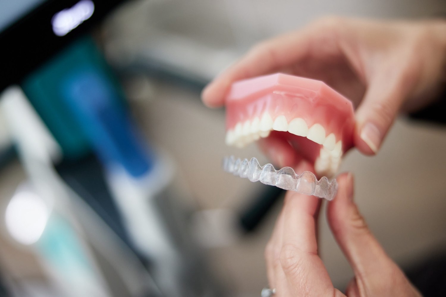 What is an Invisalign Diamond Provider? | CarolinasDentist | North Carolina
